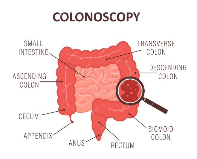 Colonoscopy Colonoscopies Procedure Guide